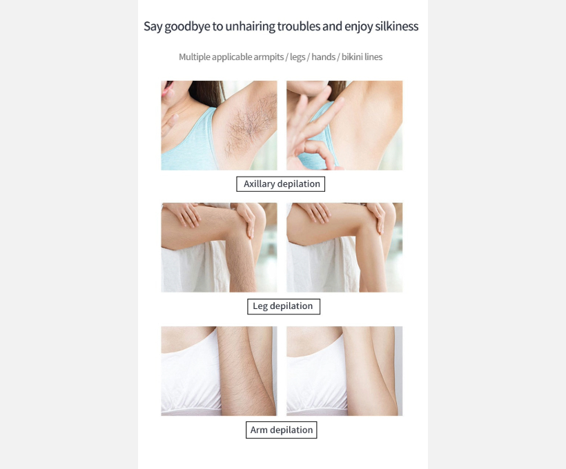 IPL Wireless Hair Removal Device – 4-in-1 Professional Laser Epilator for Effortless, Silky ...